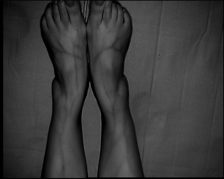 Vascular Images Displaying Veins In Screen Infrared Vein Finder For ...