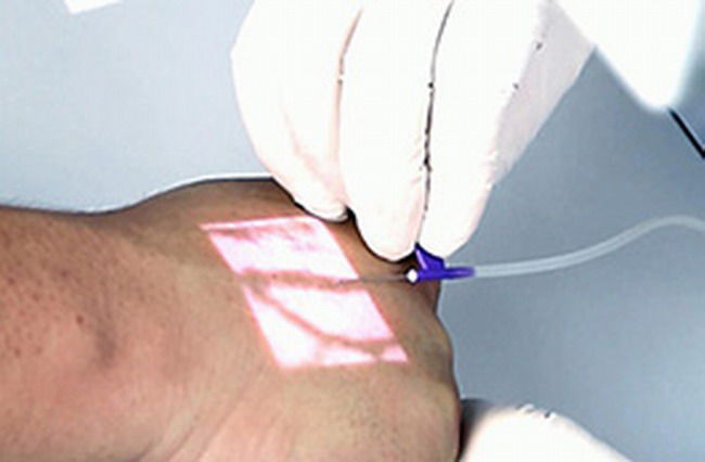 Medical Device Vein Locator Handheld Vein Finder For Venipuncture Using ...